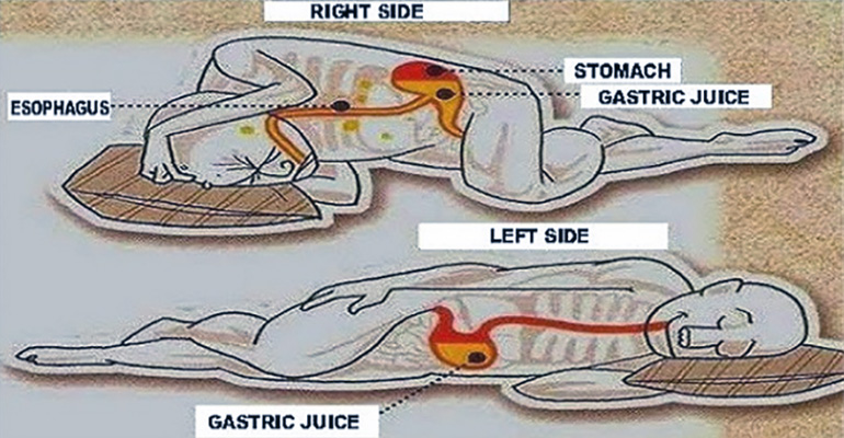Sleeping On Your Left Side Can Help With Digestion And Prevent Heartburn